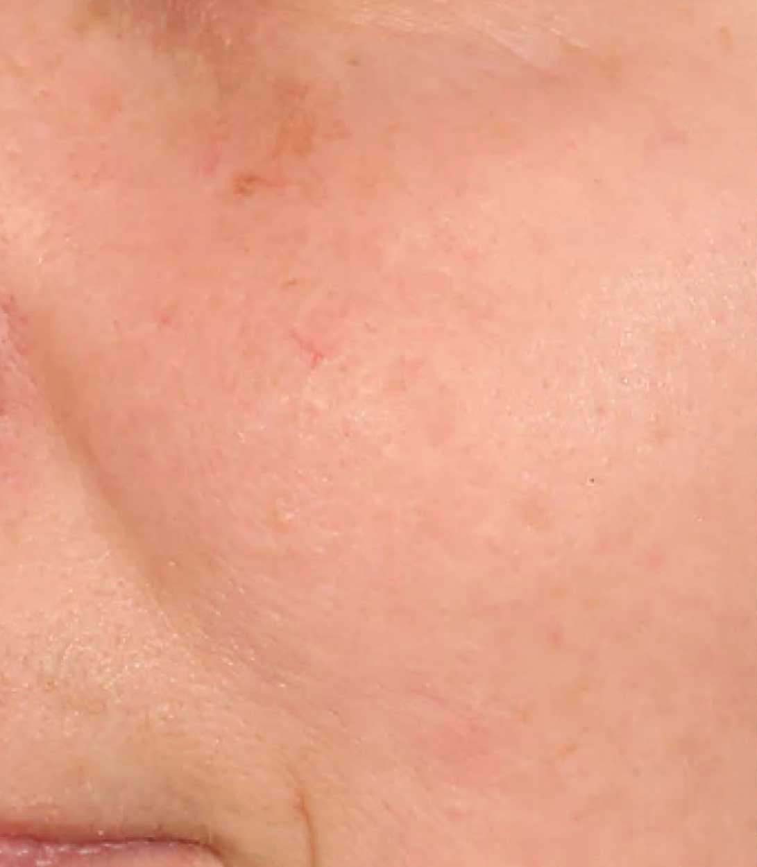 The Resurface + Restore Set – U Beauty